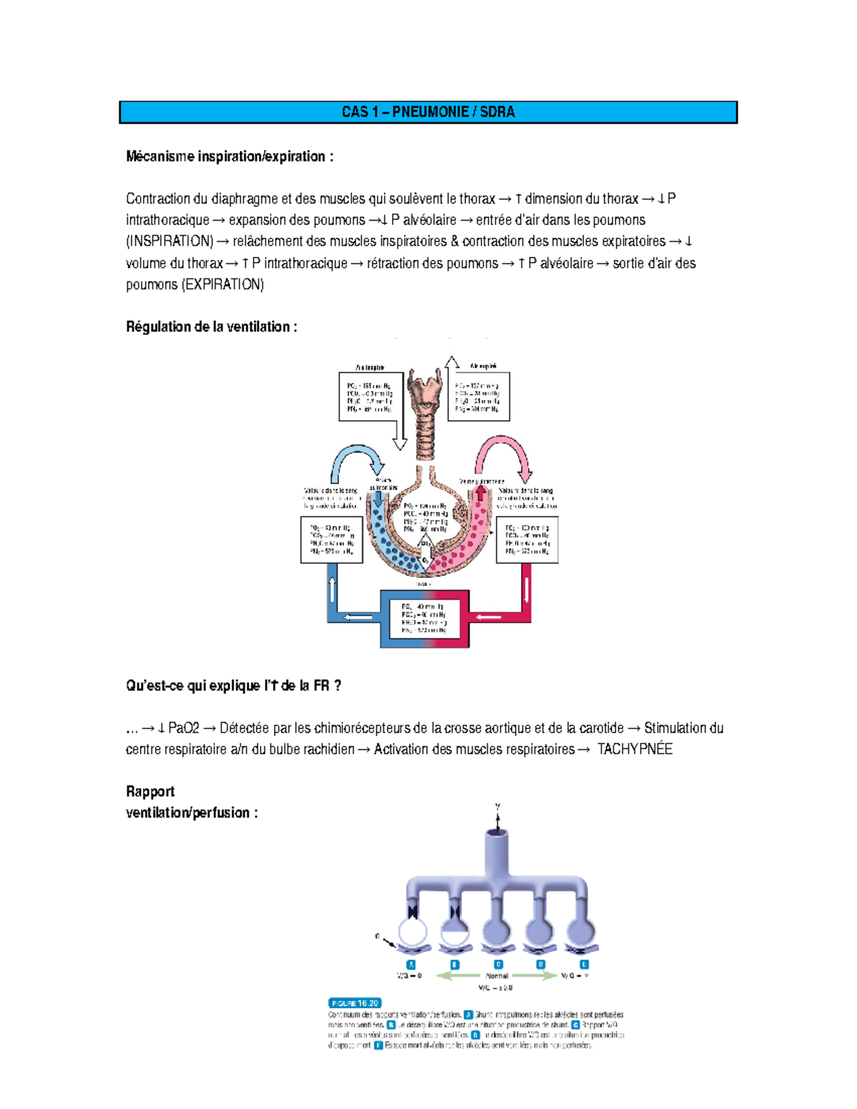 Résumé-Cas-123 - Résumé examen 1 - CAS 1 – PNEUMONIE / SDRA Mécanisme ...