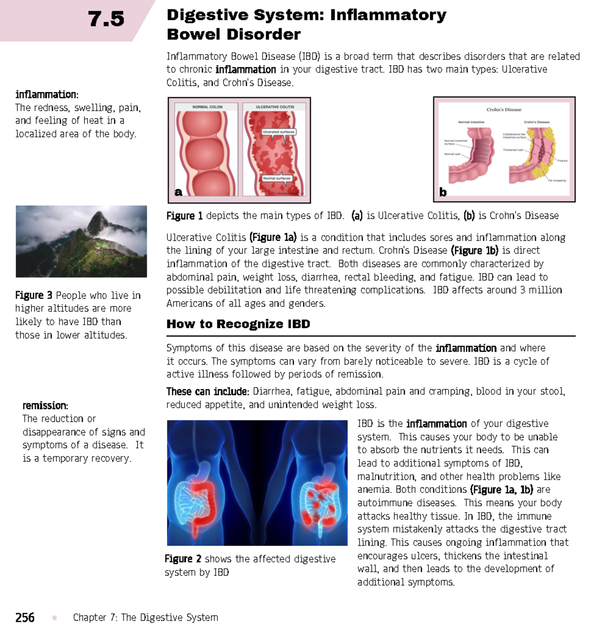 Bio culminating part 1 - 7 Digestive System: Inflammatory Bowel ...