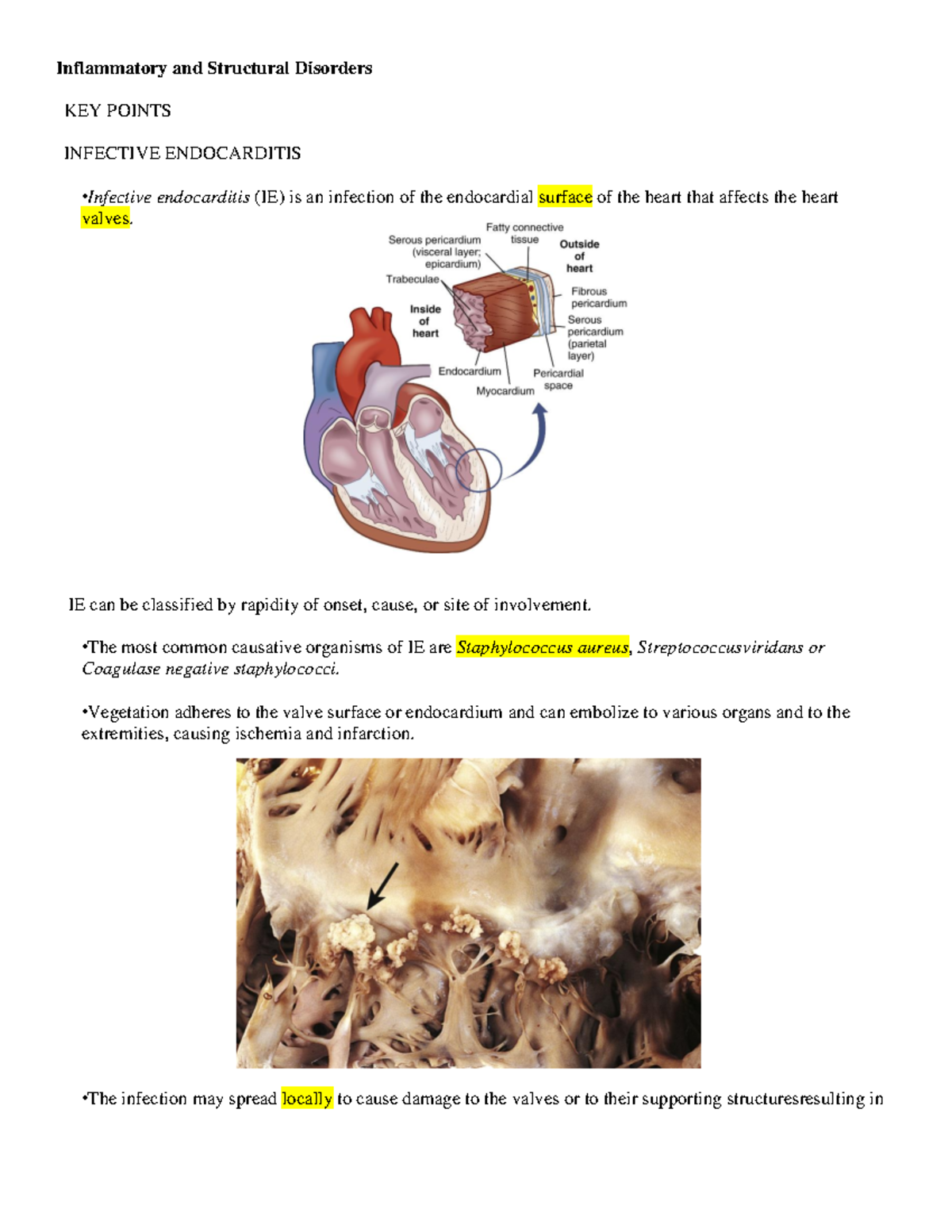 Guided Notes Inflammatory and Structural Heart Disorders-1 ...