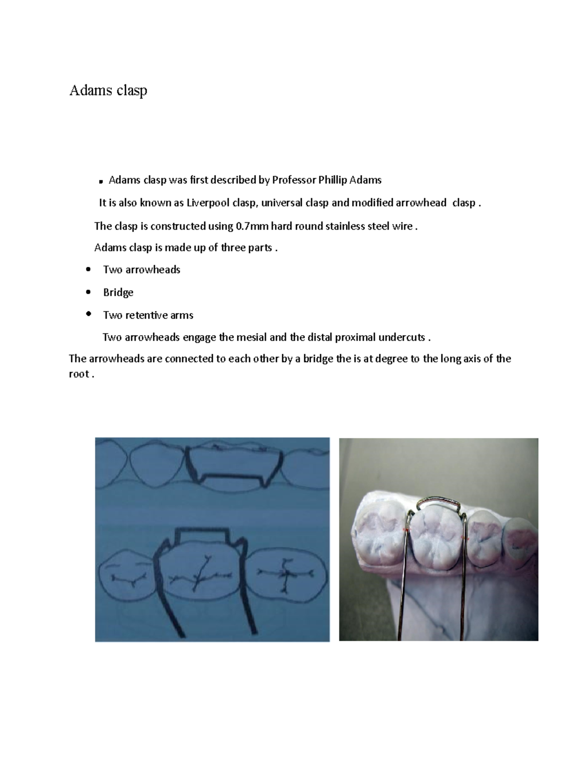 Adams clasp - Adams clasp was irst described by Professor Phillip Adams ...