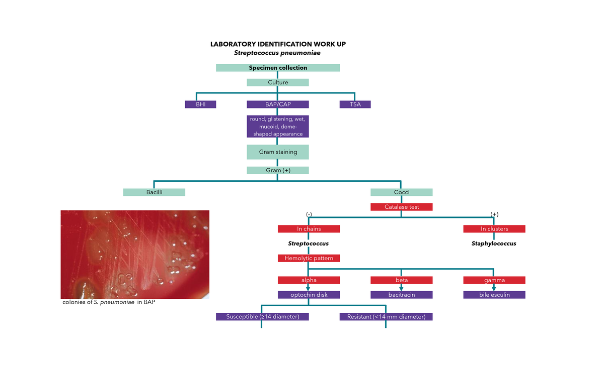 Work-up - One of the assignments - BHI TSA Streptococcus pneumoniae ...