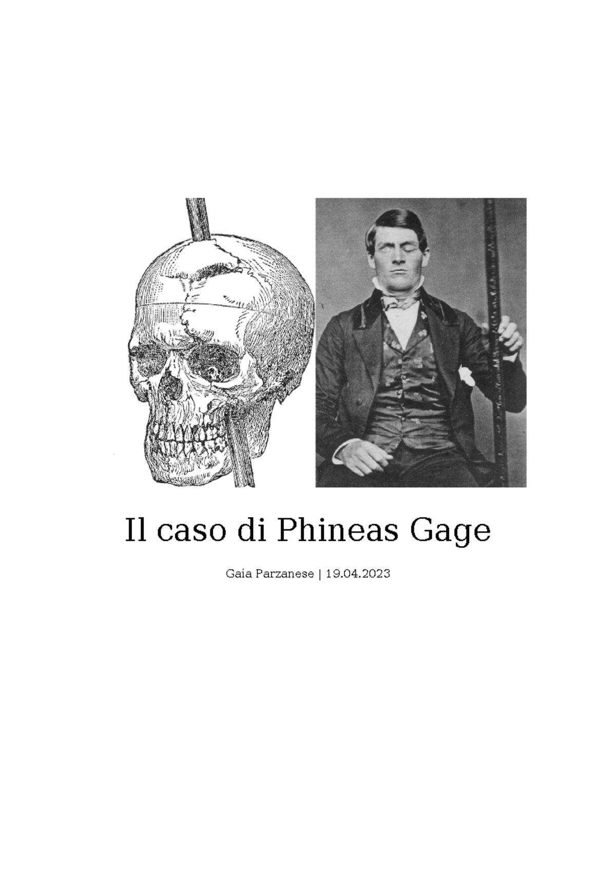 Research on the case of Phineas Gage an American railroad construction ...
