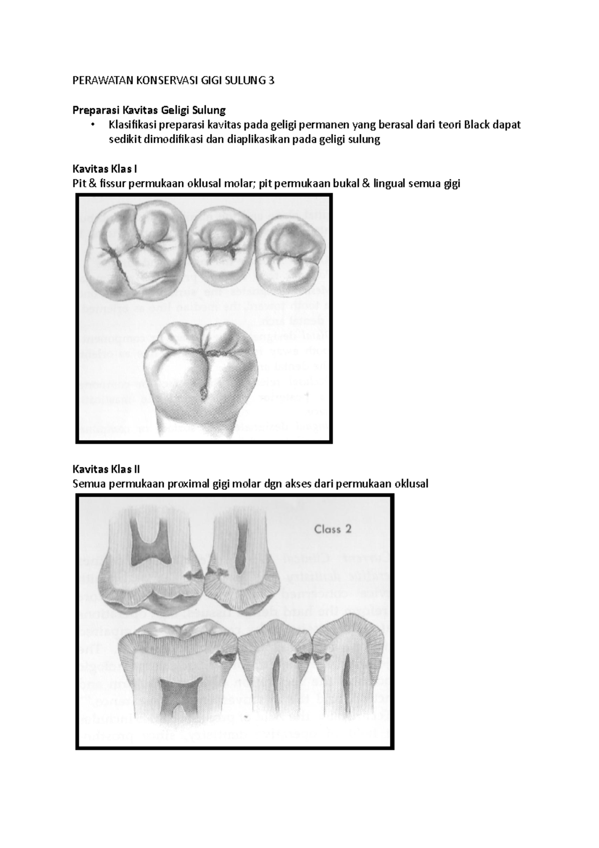 Perawatan Konservasi Gigi Sulung 3 - PERAWATAN KONSERVASI GIGI SULUNG 3 Preparasi Kavitas Geligi ...