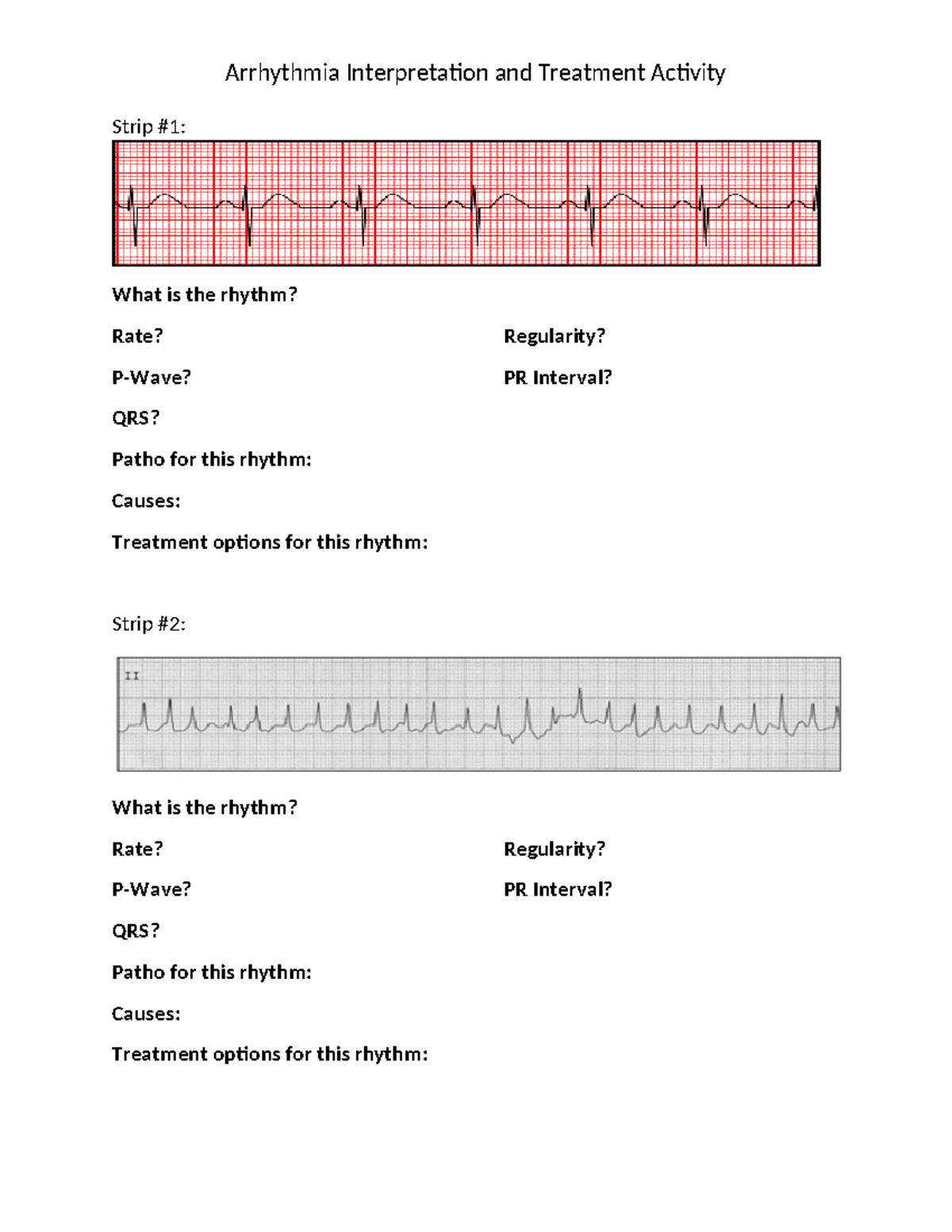 Arrhythmia 2.0 - All the questions in the case study give detailed explanations and rationale ...