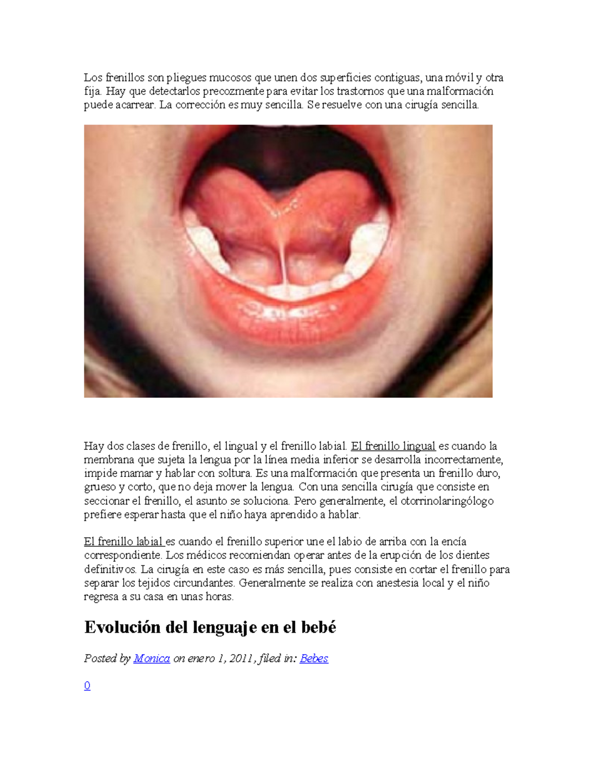 Los frenillos son pliegues mucosos que unen dos superficies contiguas ...