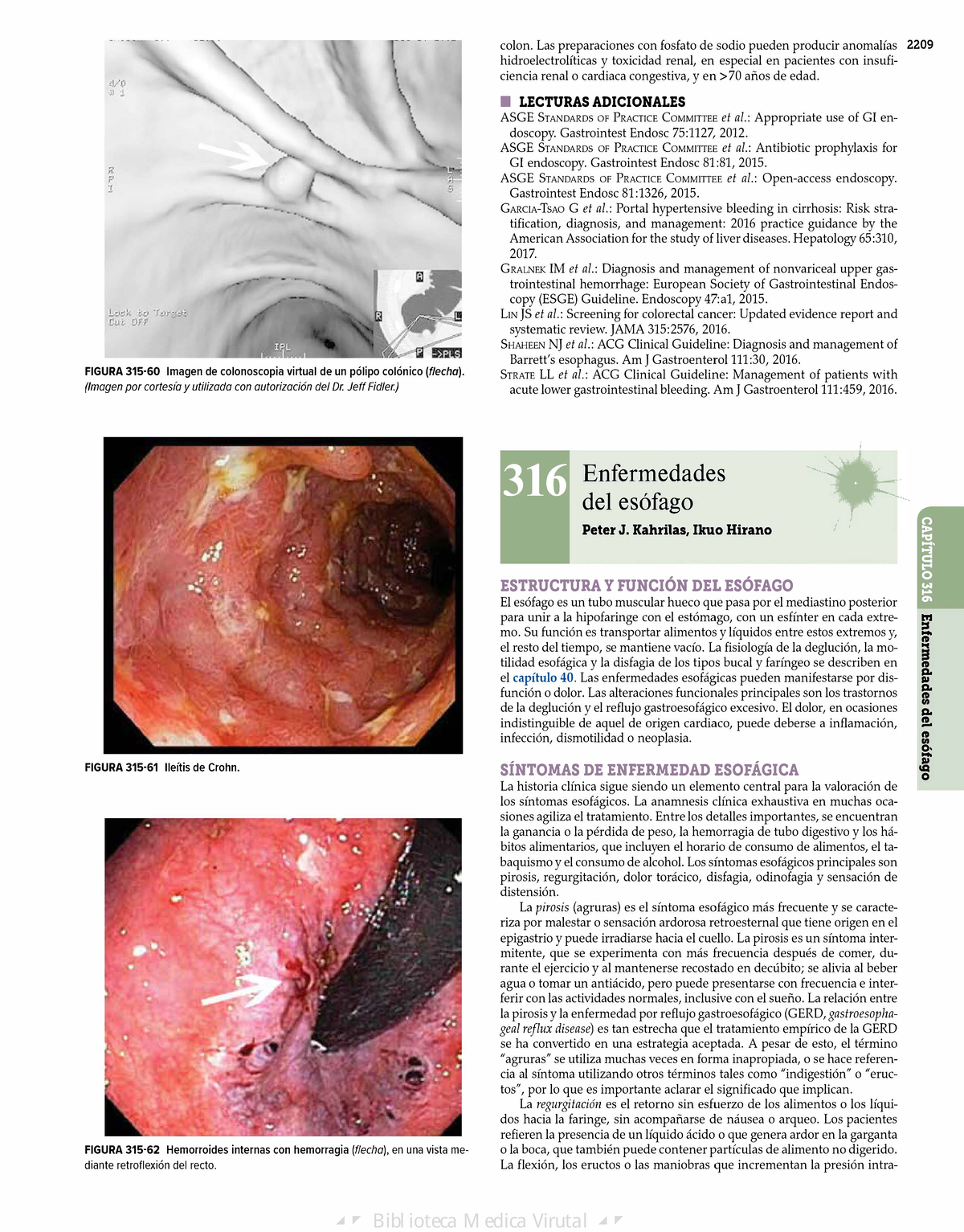 Harrison, 20 Ed. Capítulo 316 - FIGURA 315-60 Imagen de colonoscopia ...