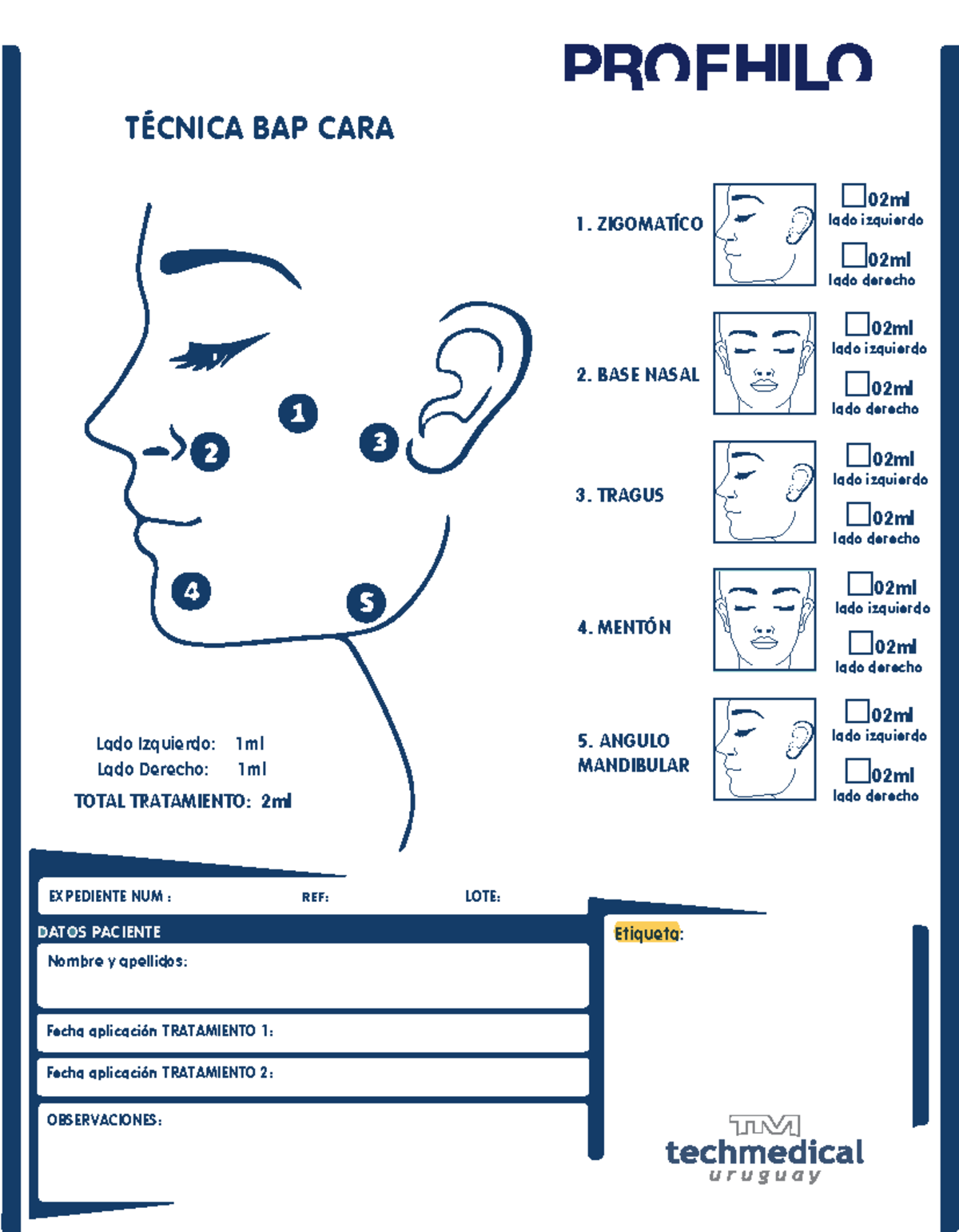 Profhilo puntos de aplicacion - técnica bap CARA Lado Izquierdo: 1ml ...