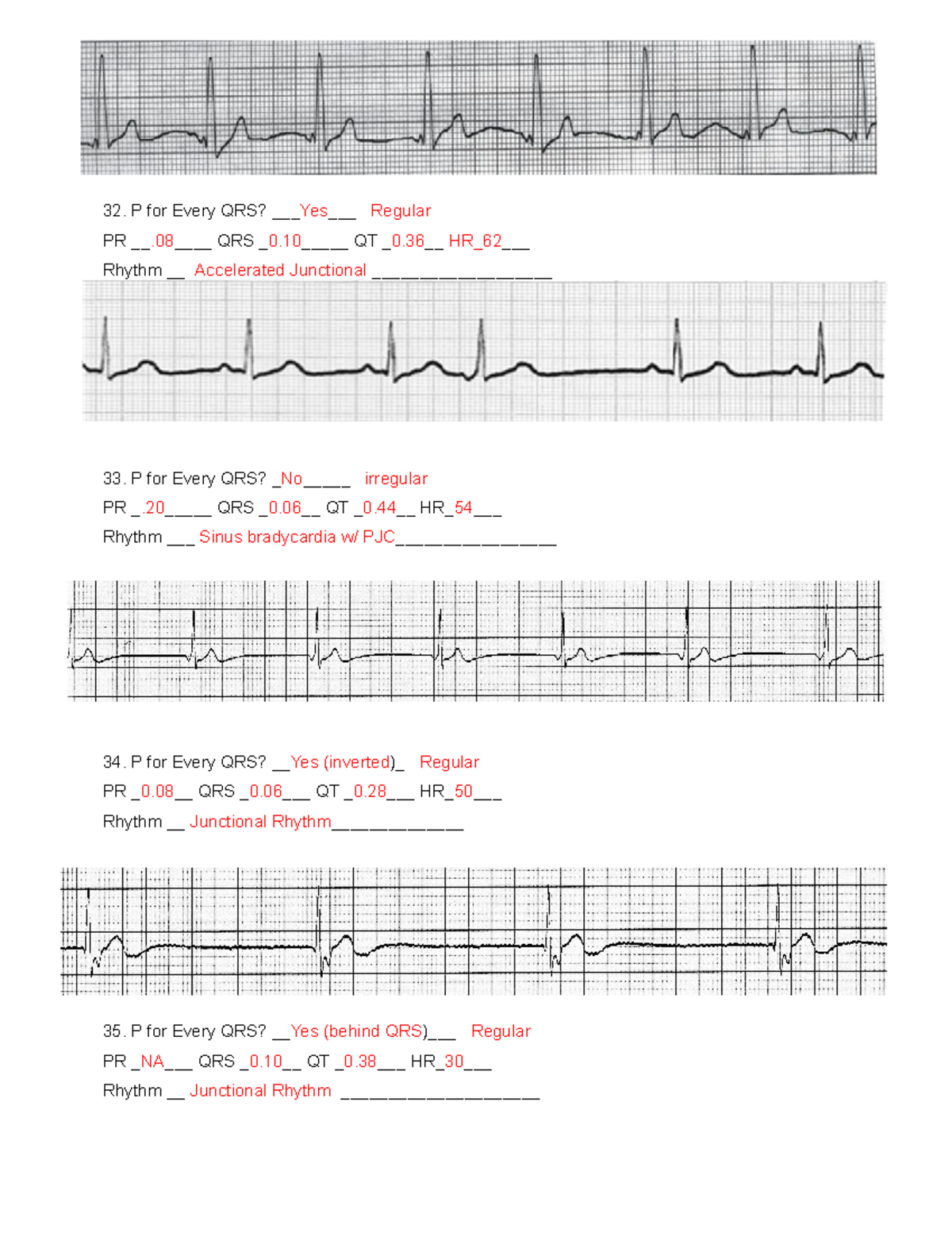 Ecg 34-45 - ecg workbook pages - P for Every QRS? Yes Regular PR ...