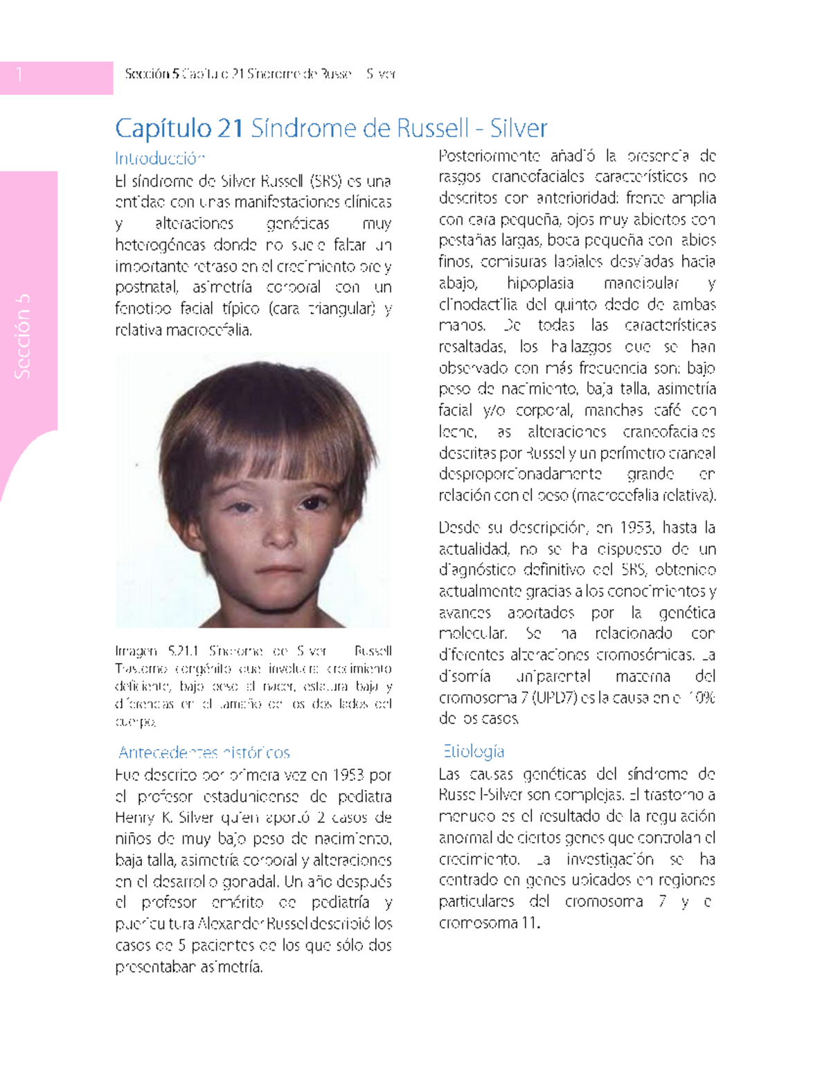 Capítulo 21 -Síndrome de Russell - Silver - Epidemiología y Salud ...