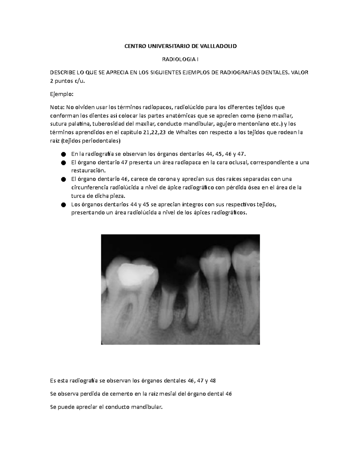 Examen de radiología - CENTRO UNIVERSITARIO DE VALLLADOLID RADIOLOGIA I ...