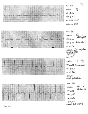EKG Practice Strips 2 Answer Key - NRSE 4610 - ETSU - Studocu