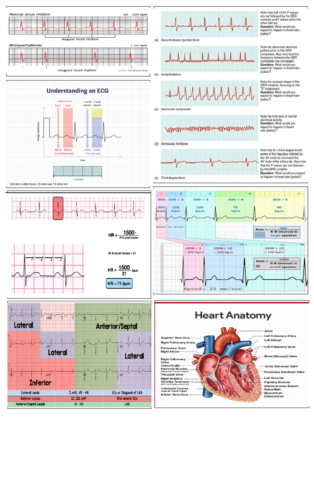 Ecg - 123456789 - fundamentals of nursing - Studocu