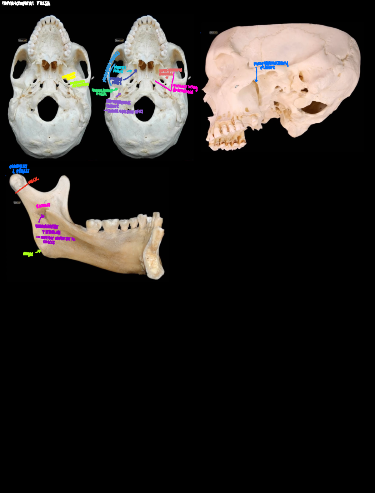 Practical Bones - Good - BSC 2085C - mmmm im intratempora Foramate peon ...