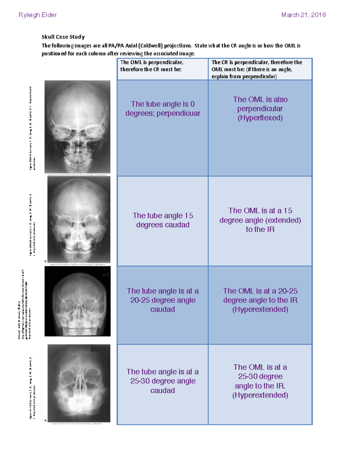 Skull Case Study Mar 2018 - Ryleigh Elder March 21, 2018 Skull Case ...