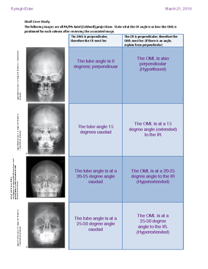 Positioning of Skull (final) - Positioning of the Skull General ...