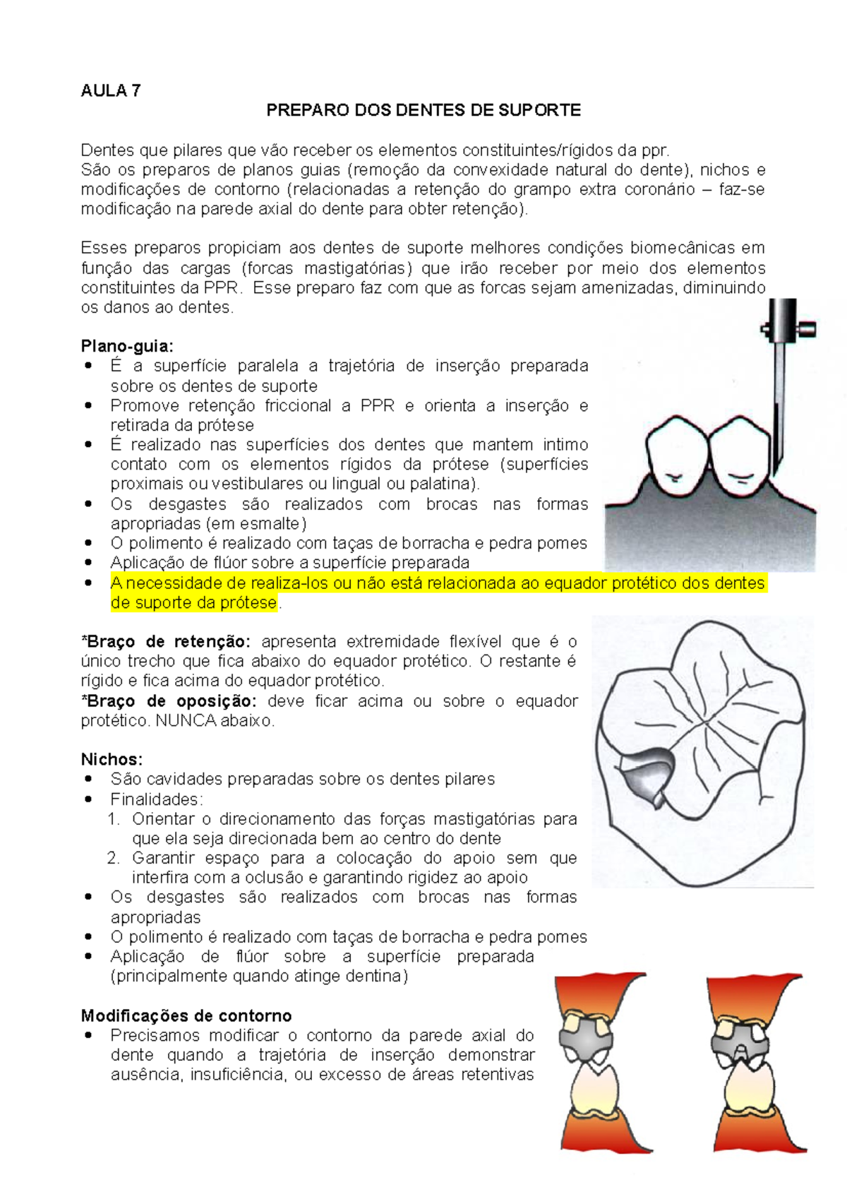PREPARO DOS DENTES DE SUPORTE - AULA 7 PREPARO DOS DENTES DE SUPORTE ...
