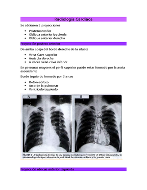 SCAI - Escala de Choque Cardiogenico - Cardiología - Studocu