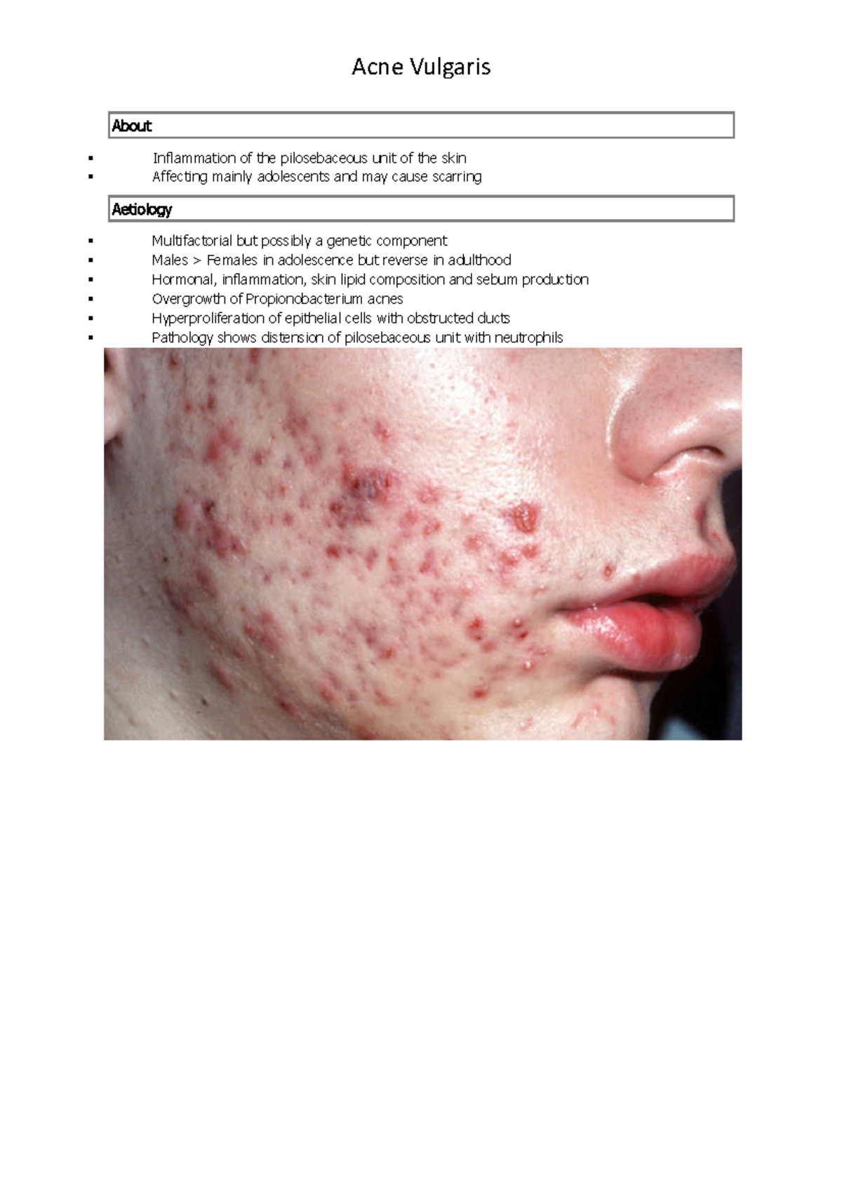 Acne vulgaris - Lecture notes 1 - Acne Vulgaris About Inflammation of ...
