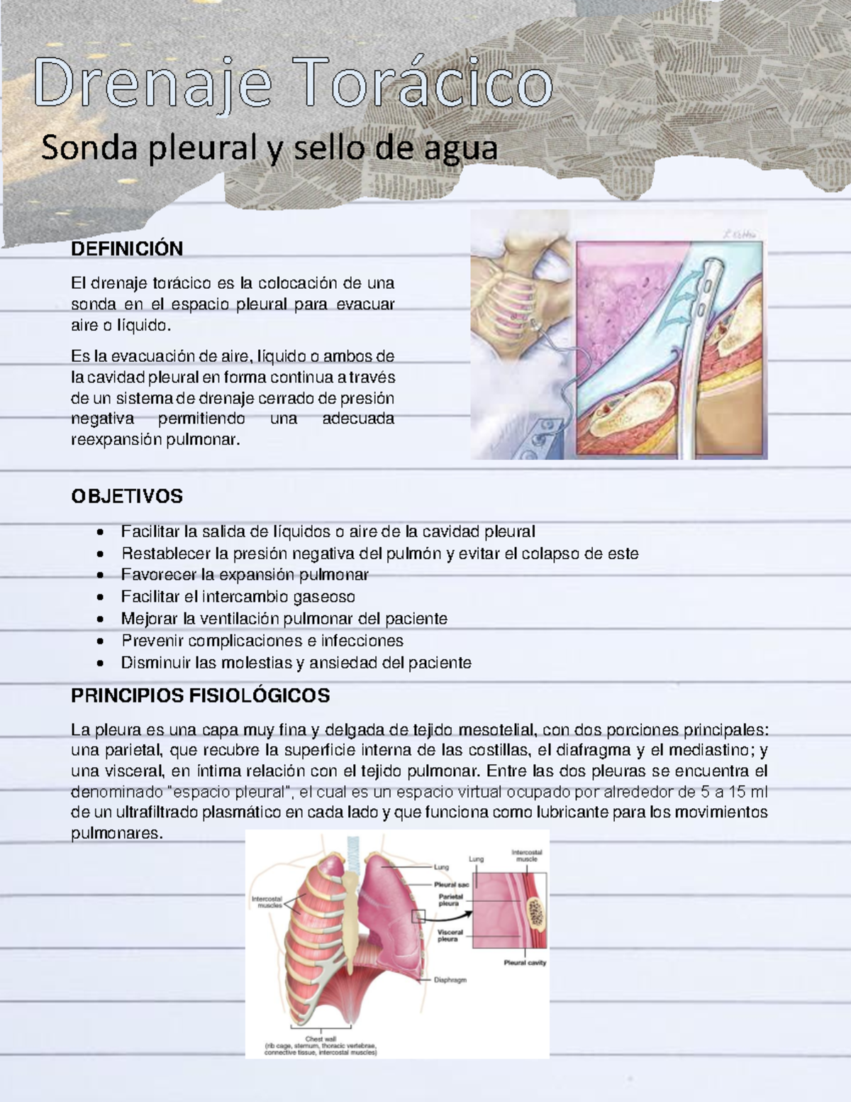 Drenaje toracico - Drenaje Torácico Sonda pleural y sello de agua ...