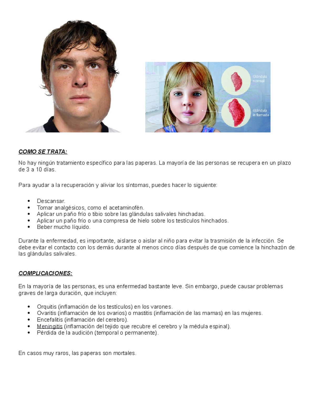 Paperas - COMO SE TRATA: No hay ningún tratamiento específico para las ...