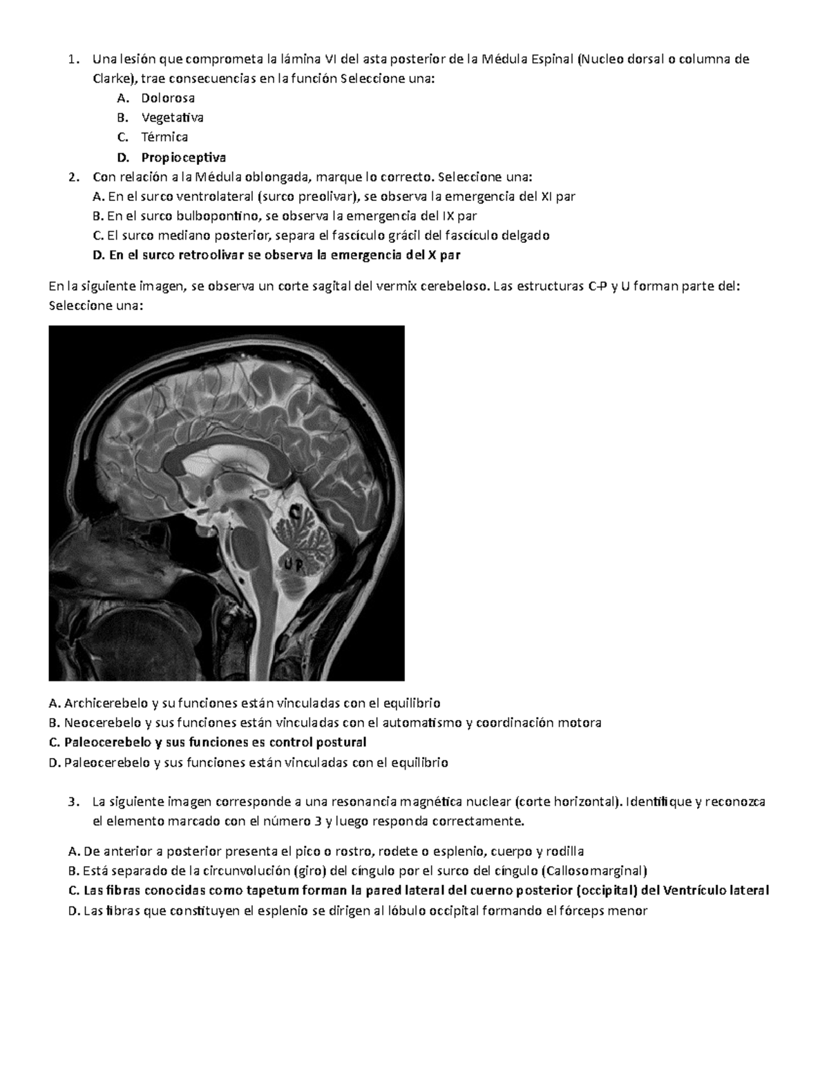 Preguntas Nervioso 1 Final - Una lesión que comprometa la lámina VI del ...