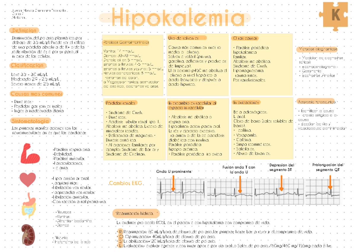 Hipokalemia - Hipokalemia Definicion Disminución del potasio plasmático ...