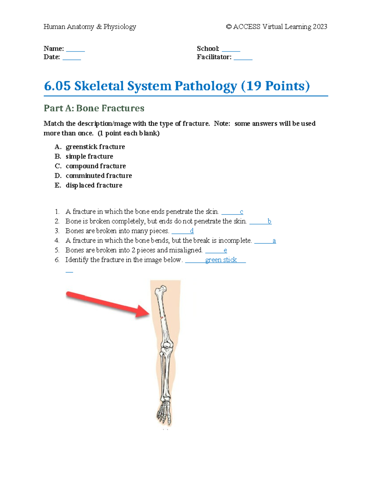 06-05 task1 - o find the correct procedure code for Sherry Moore's open ...