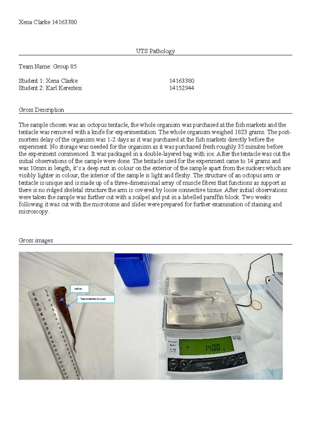 Gross discription 14163380 - Xena Clarke 14163380 UTS Pathology Team ...
