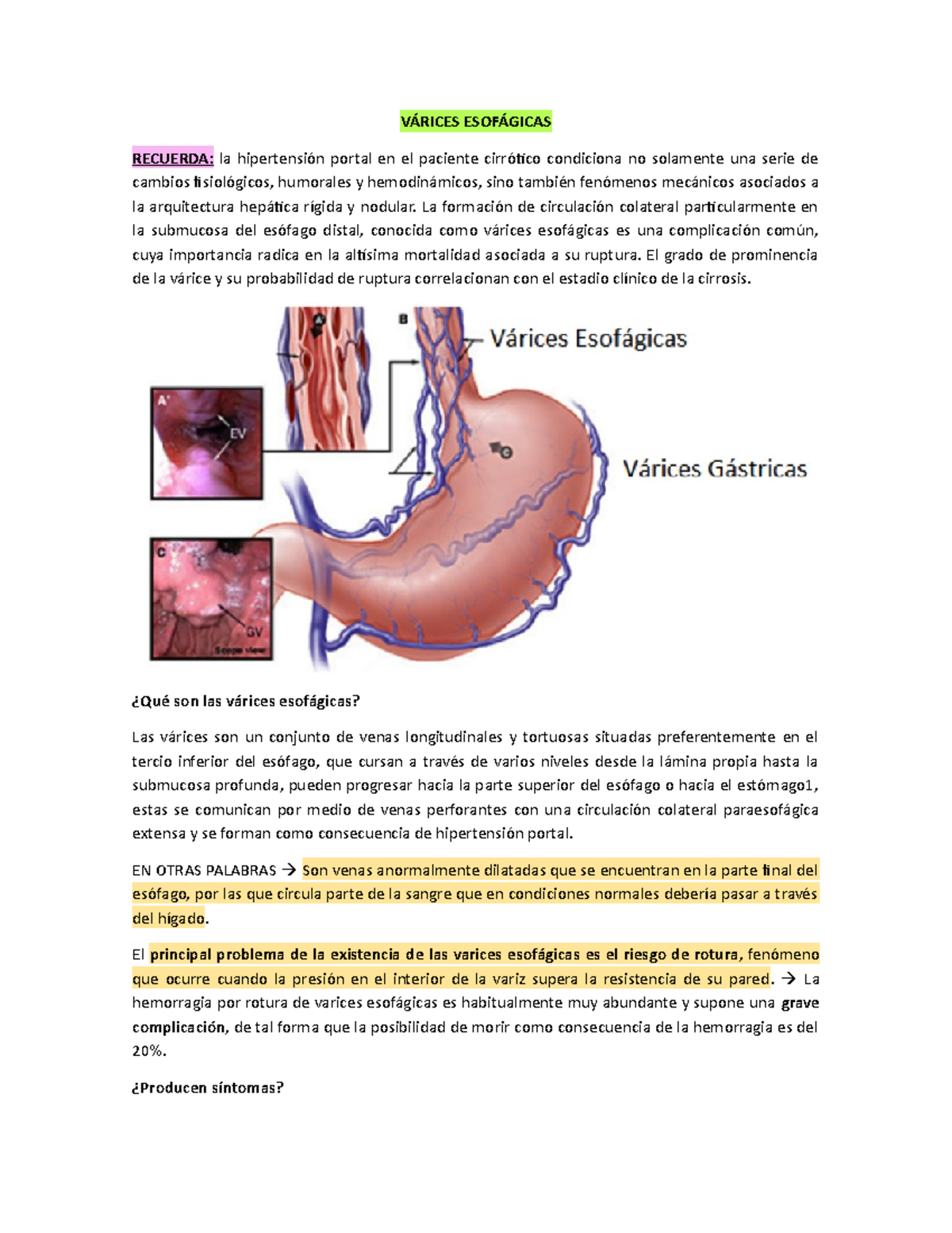 Várices esofagicas - Varices - VÁRICES ESOFÁGICAS RECUERDA: la ...