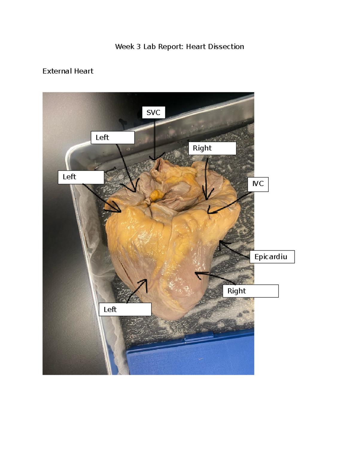 Heart Lab Report - BIOS-255 - Week 3 Lab Report: Heart Dissection ...