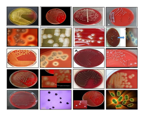 Bacteria - 5-2 micron in diameter) it ####### can be seen just under ...