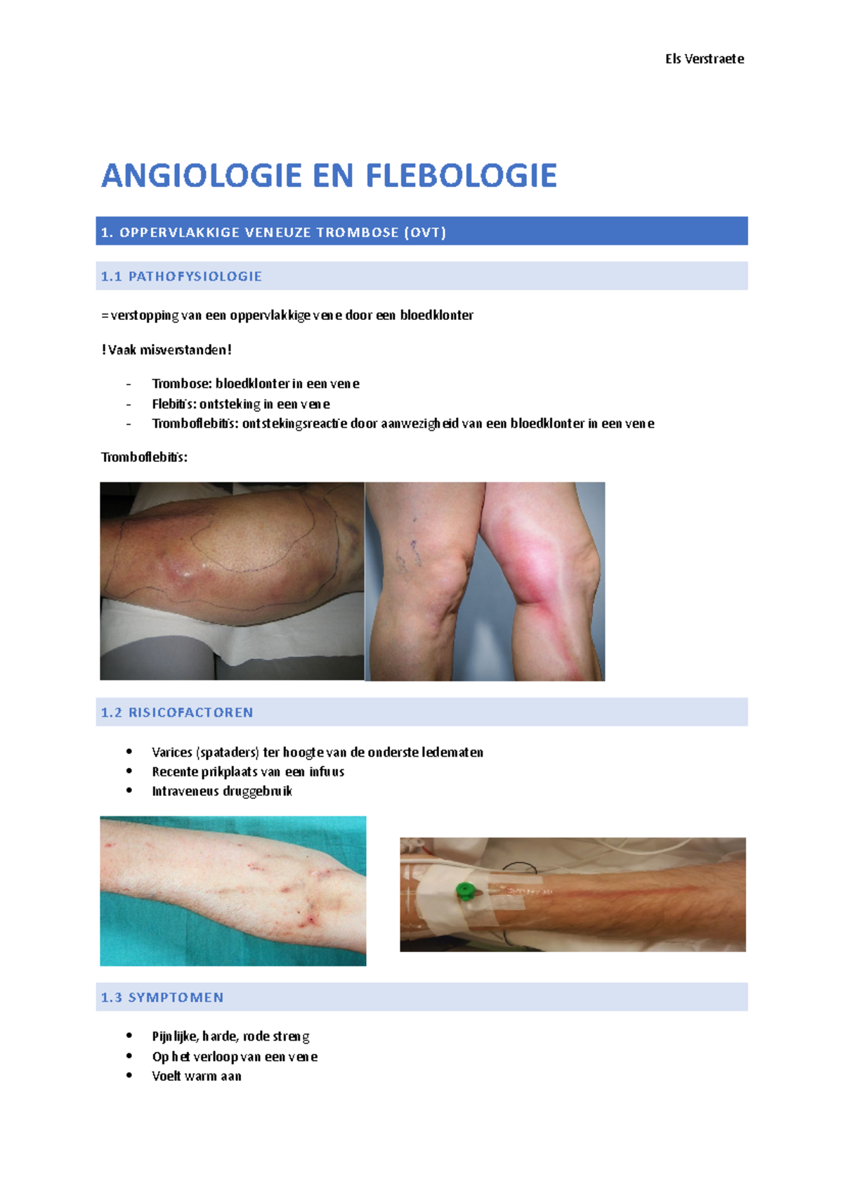 Angiologie en Flebologie Els Verstraete - ANGIOLOGIE EN FLEBOLOGIE 1 ...
