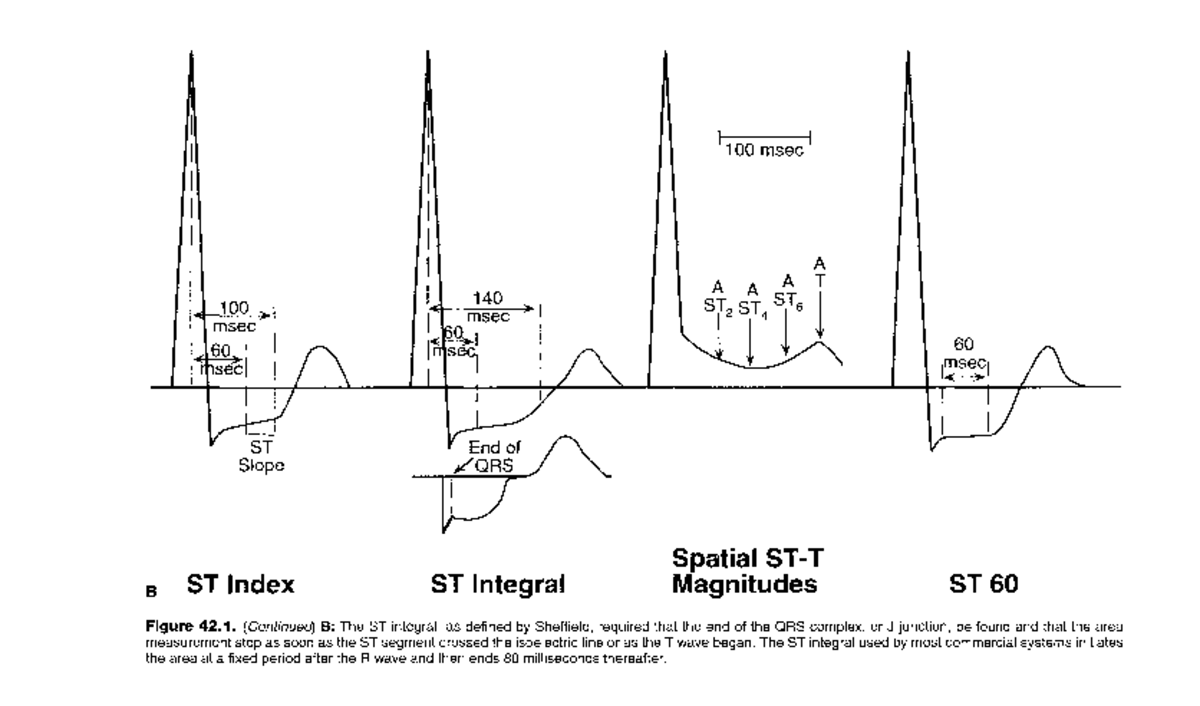 Manual OF Cardiovascular Medicine 3rd-551-800-16 - 140 B STlndex ST ...