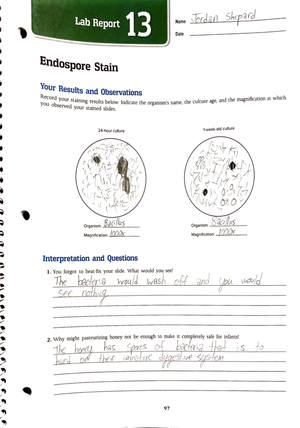Lab Report 13 Endospore Stain - Microbio Lab 13 Lauren Burch March 14 ...