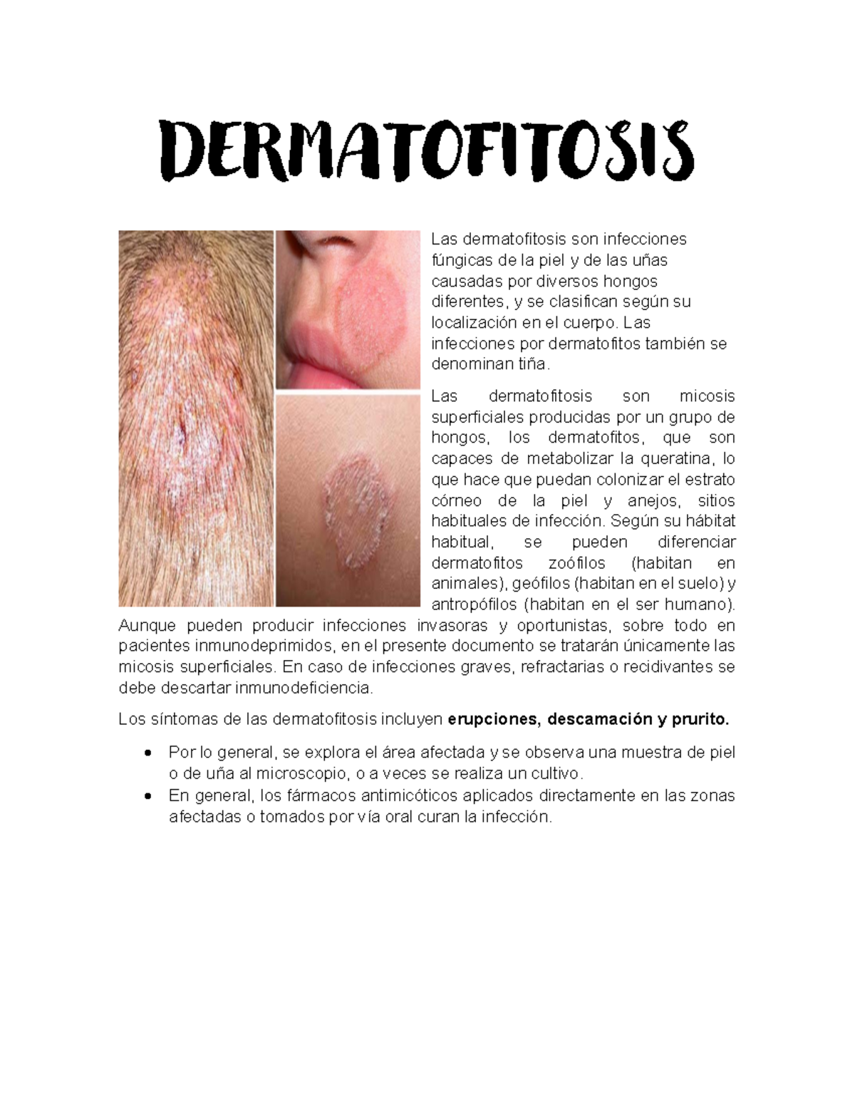 Dermatofitosis - TEMA DE REPASO. - DERMATOFITOSIS Las dermatofitosis ...