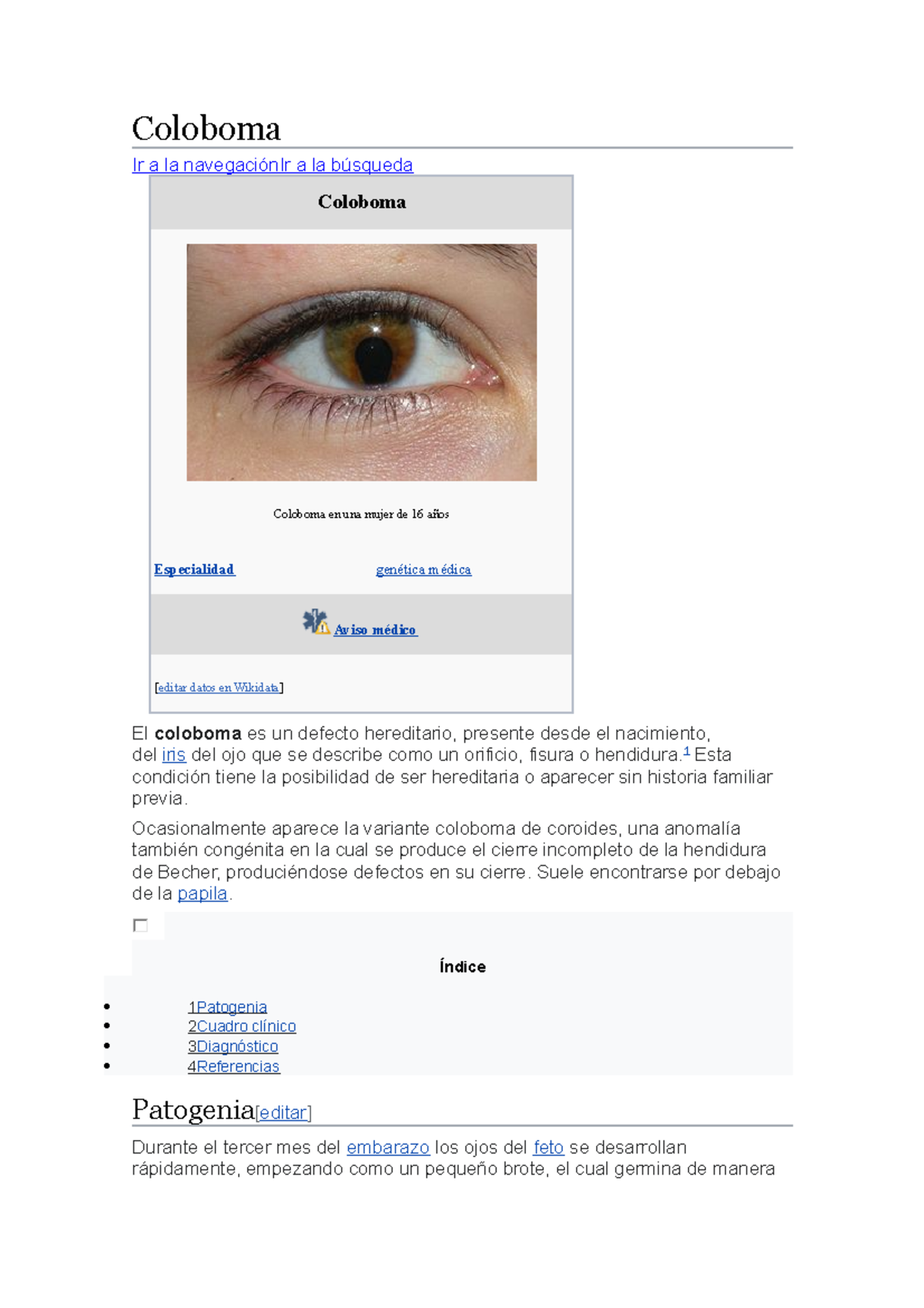 Coloboma 89Es un agujero o defecto del iris del ojo. La mayoría de los ...