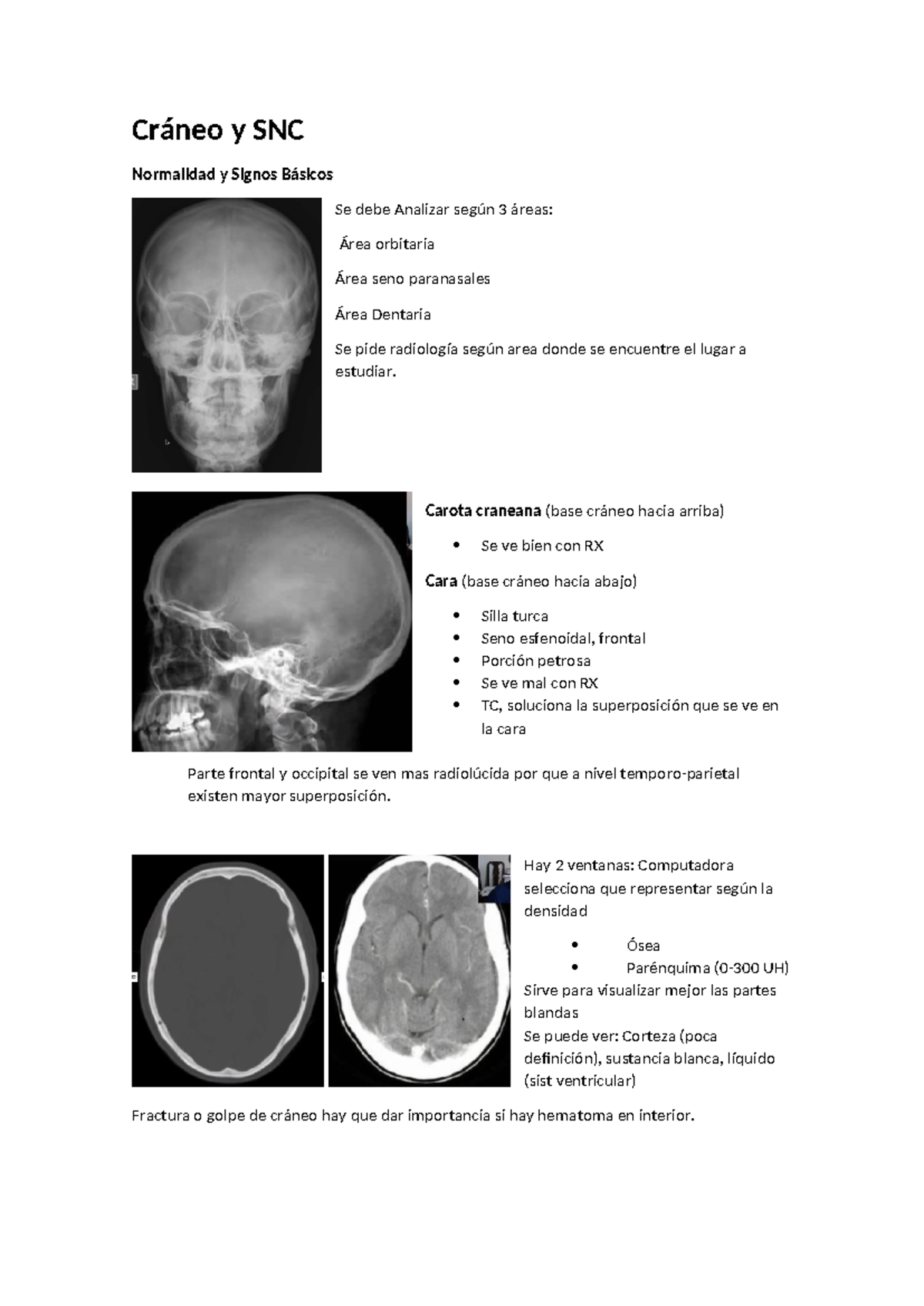 Cráneo y SNC - AAA - Cráneo y SNC Normalidad y Signos Básicos Se debe ...