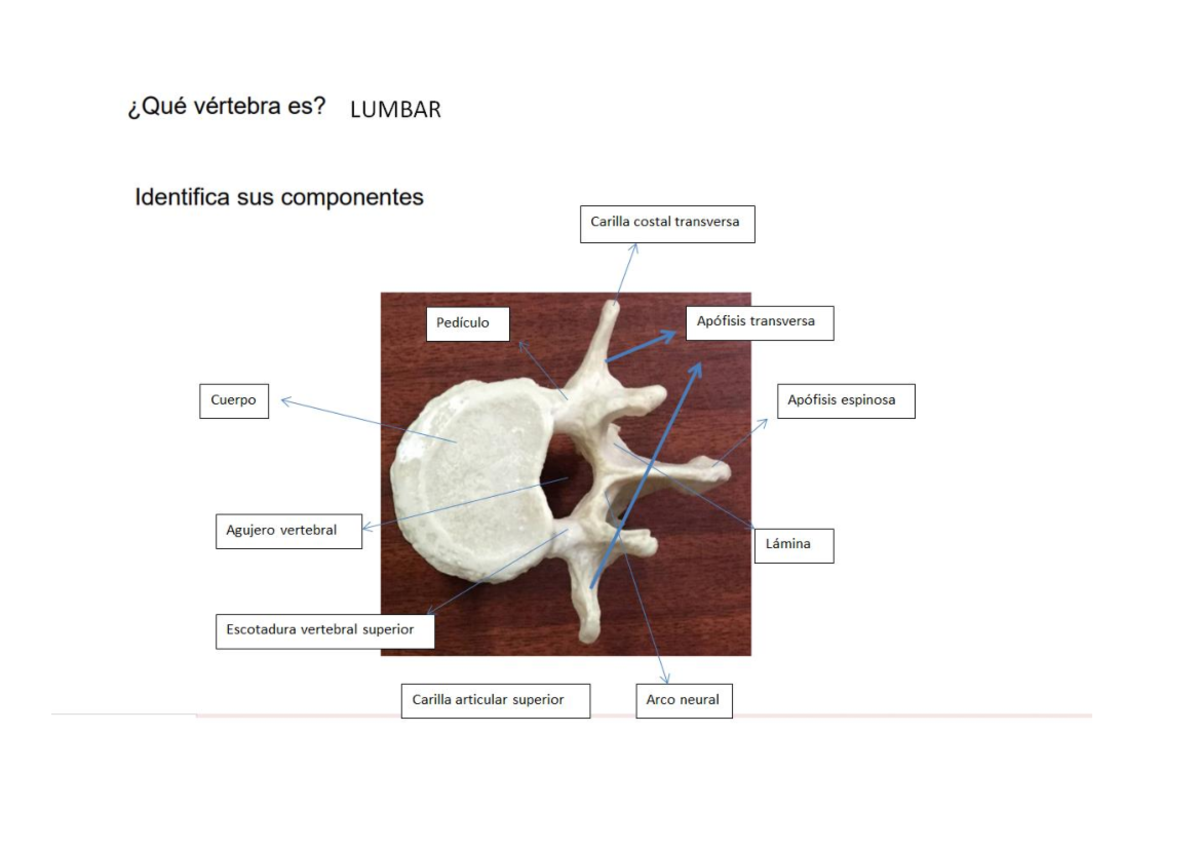 Practica 1 terminada - Cuerpo Agujero vertebral Apófisis transversa ...
