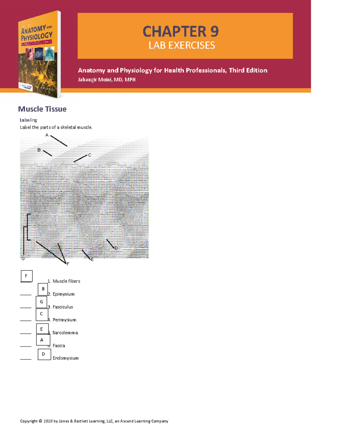 Chapter 9 Lab Exercise Kristen Armes - Labeling Label the parts of a skeletal muscle. 1. Muscle ...