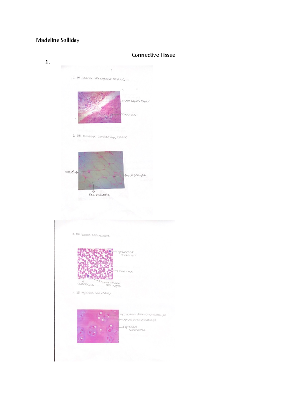 Connective Tissue Questions - Madeline Solliday Connective Tissue 1 ...