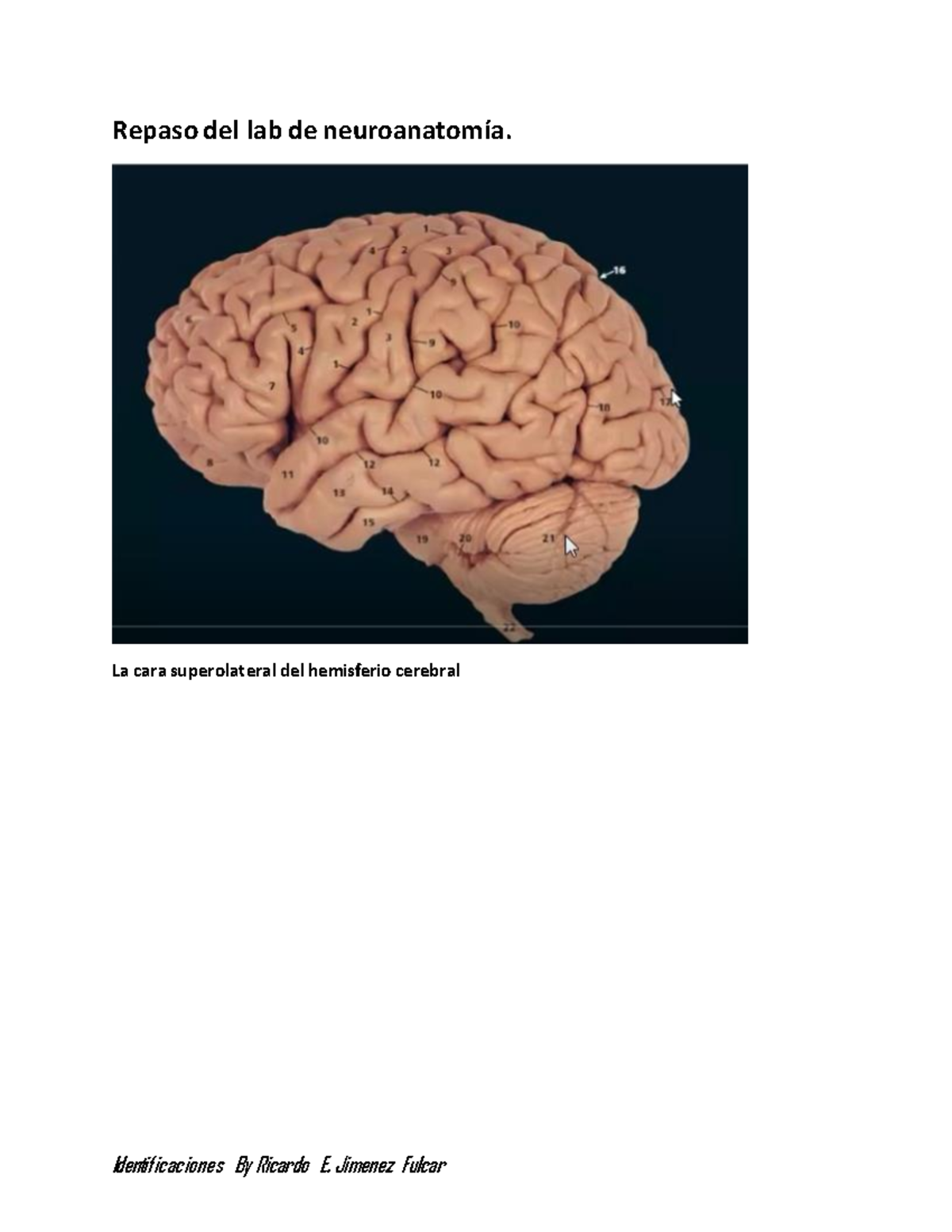 Repaso del examen final del lab neuroanatomia - Repaso del lab de ...