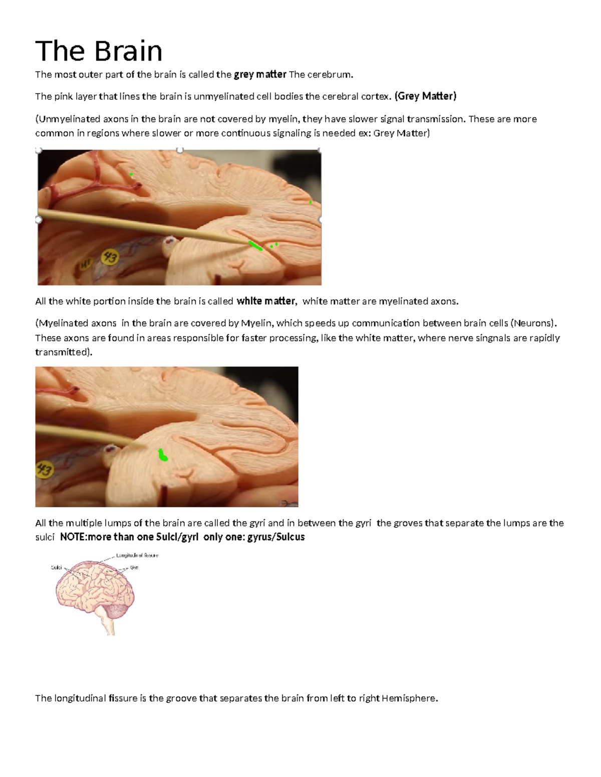 The Brain - study notes - The Brain The most outer part of the brain is ...
