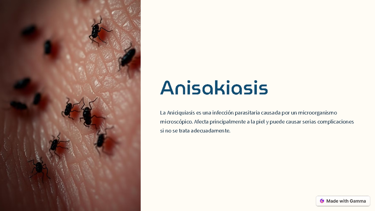Anisakiasis - anisakis es una enfermedad - Anisakiasis La Aniciquiasis ...