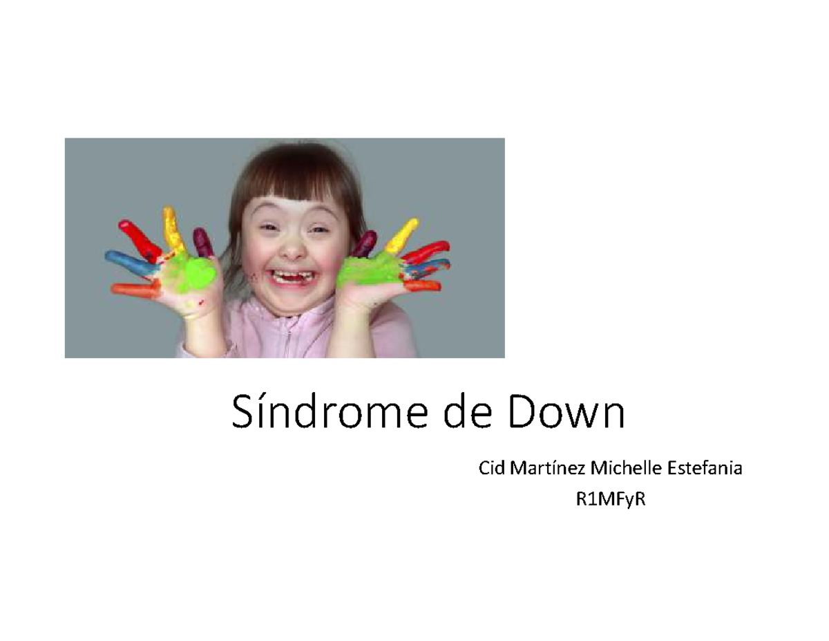 Síndrome de Down II - Resumen Embriología humana - MC - Síndrome de ...