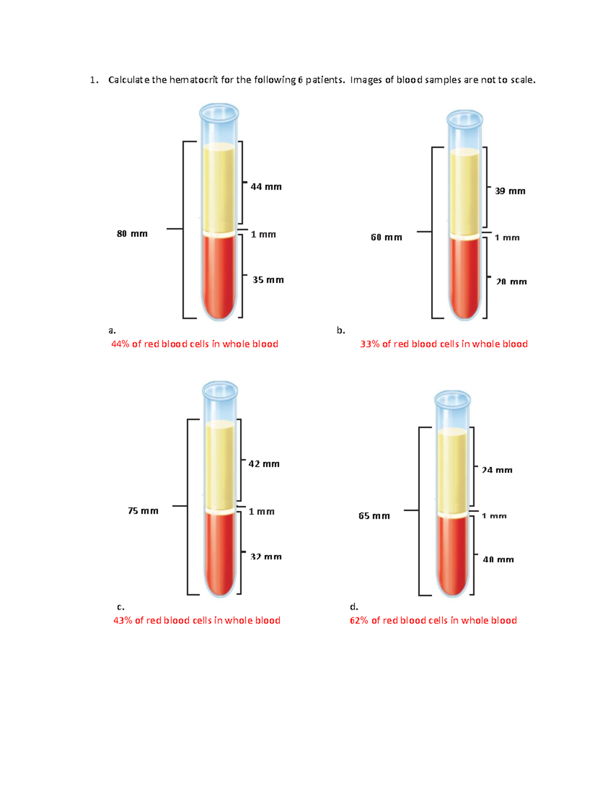 KEY Some practice with hematocrit and blood typing - Calculate the hematocrit for the following ...