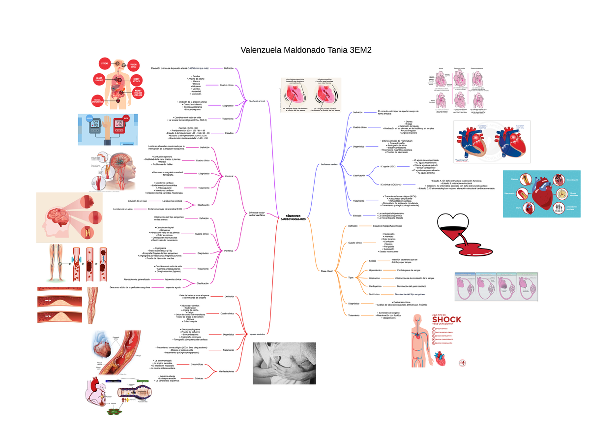 Mapa de Síndromes cardiovasculares - Diagnóstico Isquemia miocárdica ...