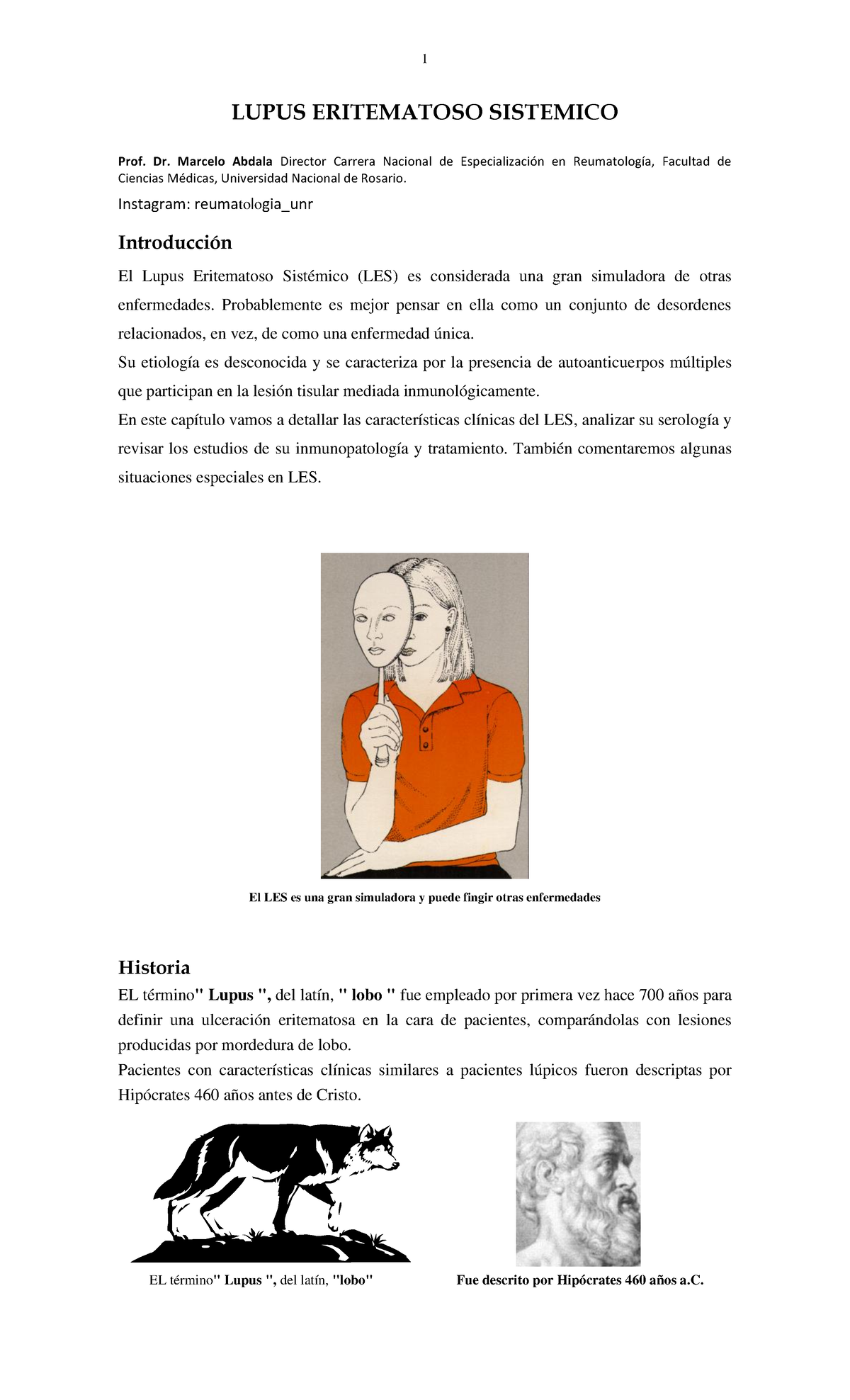 Lupus Eritematoso Sistémico - LUPUS ERITEMATOSO SISTEMICO Prof. Dr ...