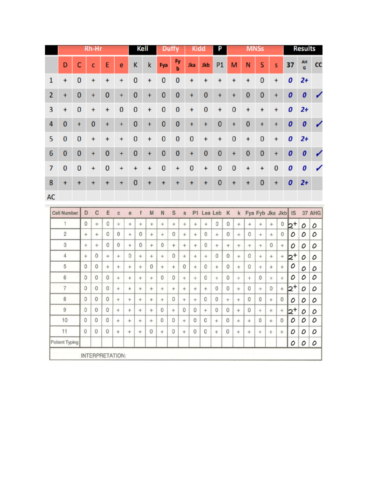 BLAB discussion and etc awdasd awdasd - ANTIBODY SCREENING Antibody ...