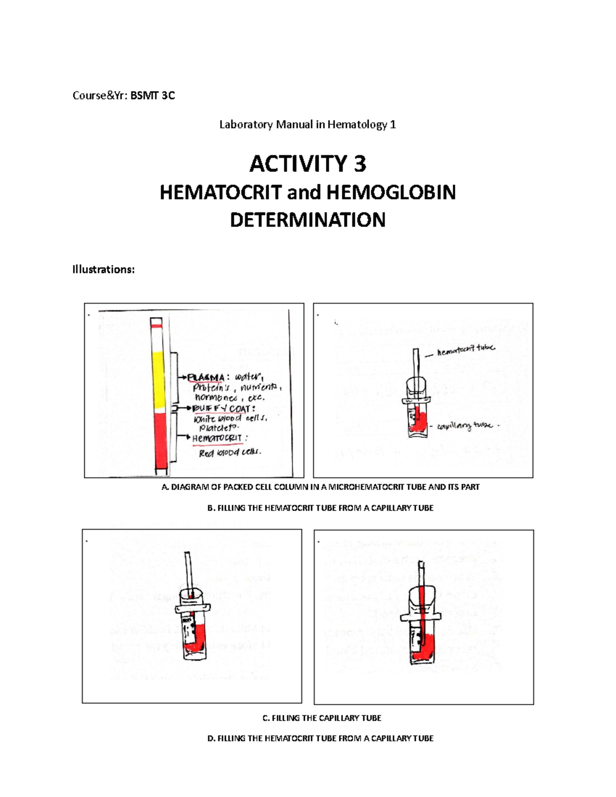 Hematocrit & Hgb determination and Hemocytometry - Course&Yr:BSMT 3C ...