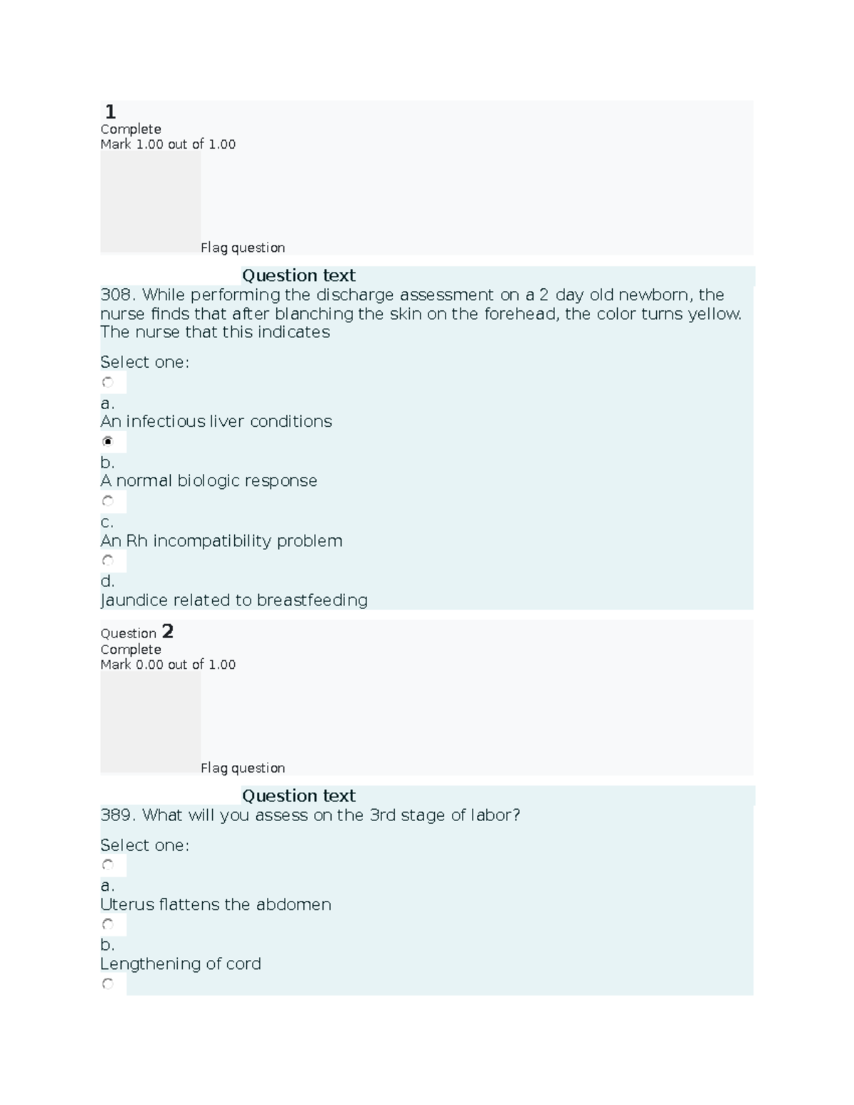 MCN UNIT EXAM - 100 items Test Exam - 1 Complete Mark 1 out of 1. Flag ...